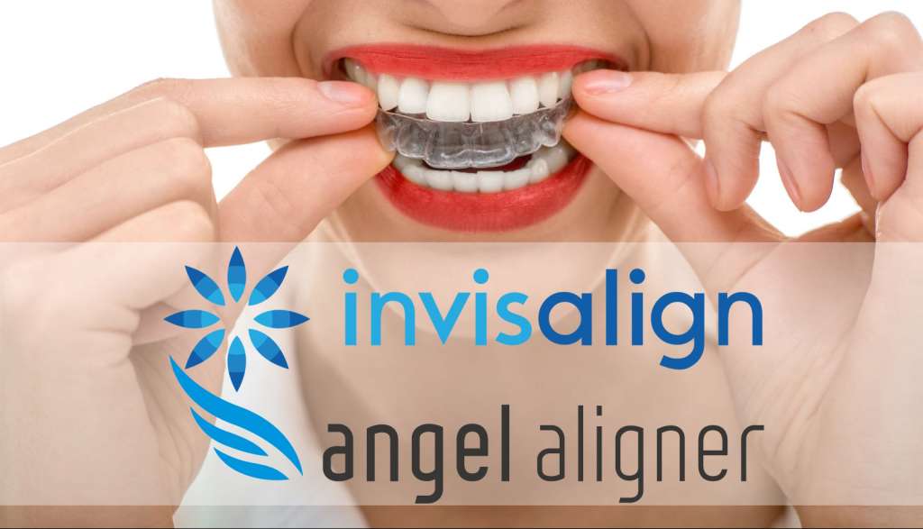 Clear Braces - Invisalign & Angel Aligner - Dr Mathias